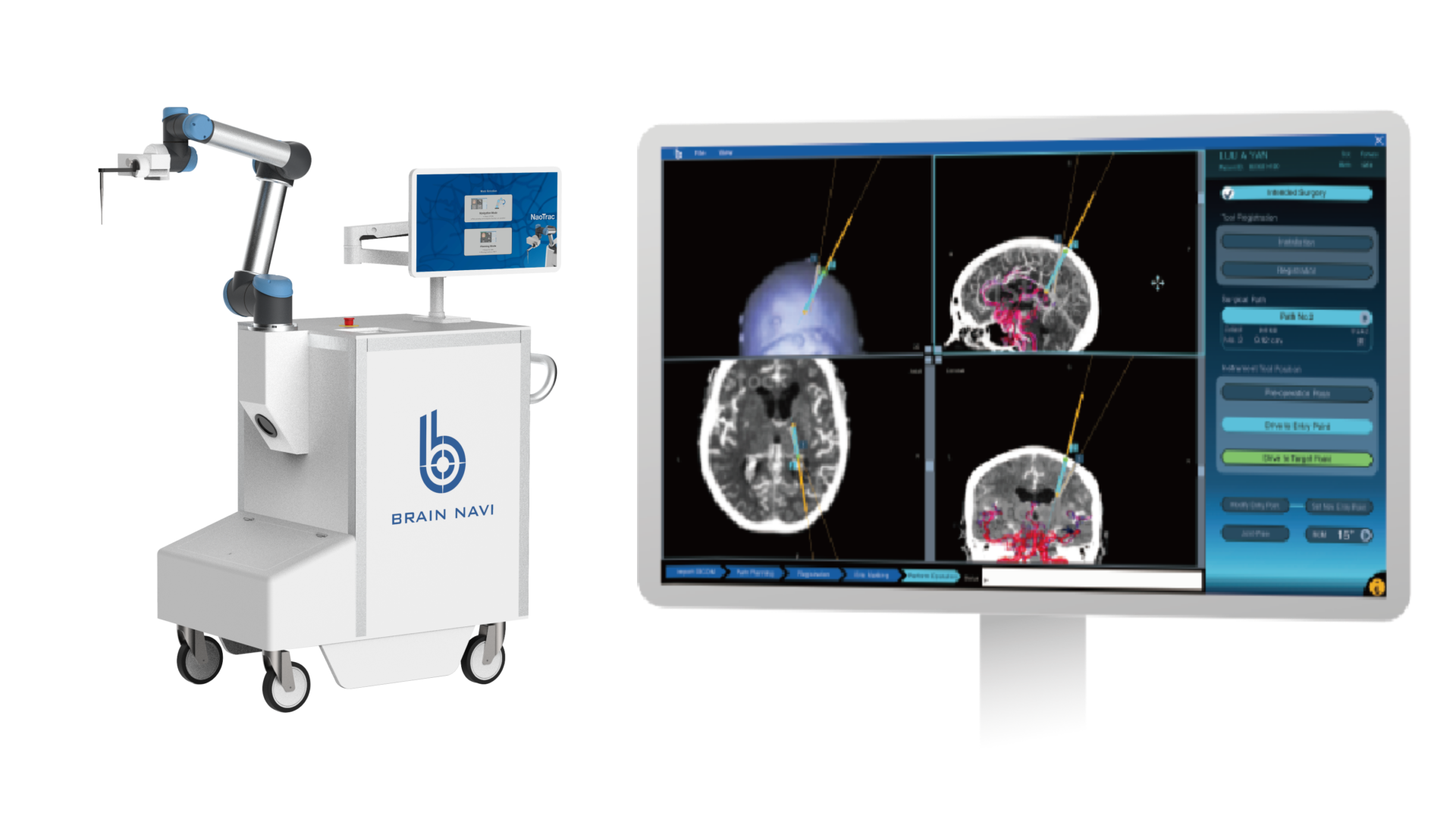 Five robot-assisted surgery startups leading the industry in 2024